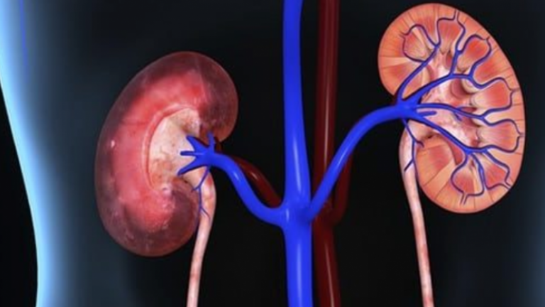 Ushqimet e përditshme të cilat mund t’iu shkaktojnë probleme në veshkat ...